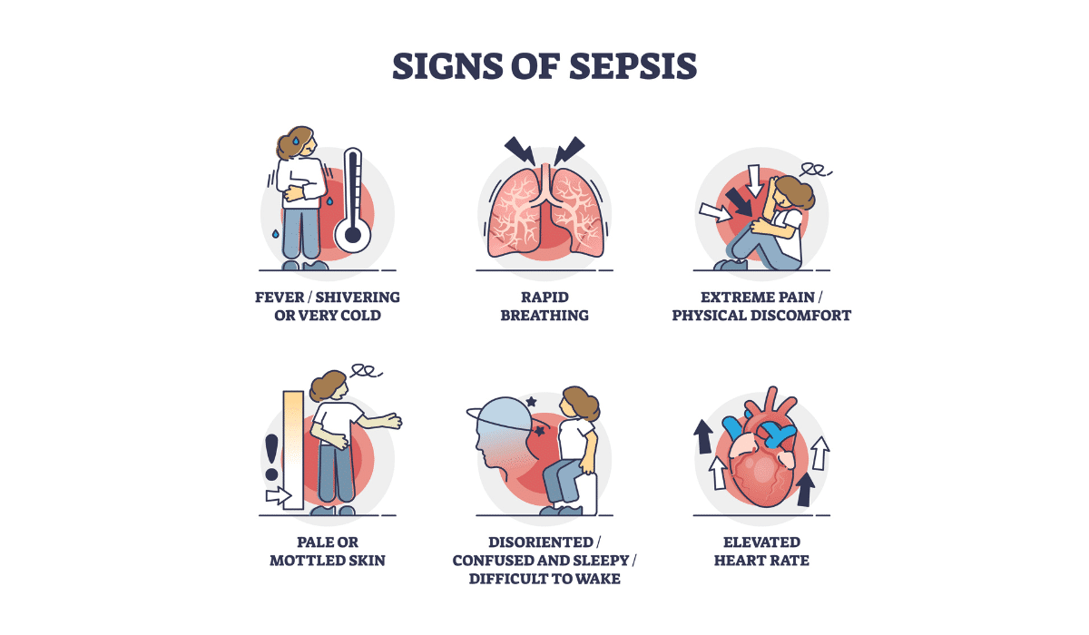 La información salva vidas, aquí te decimos qué es la sepsis