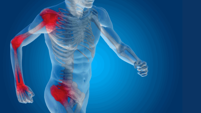 Dolor articular: qué significa según la zona del cuerpo donde se presenta